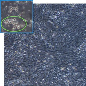 Synova® Life Sciences | Revitalize with your fat! 1 (833) SYNOVA-1